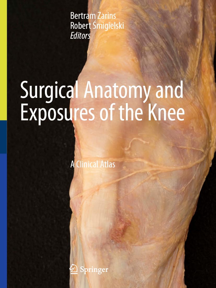 Amazon | Surgical Anatomy and Exposures of the Knee: A Surgical Atlas ...