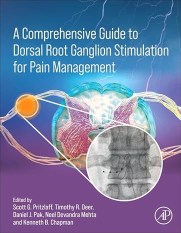 A Comprehensive Guide to Dorsal Root Ganglion Stimulation for Pain ...