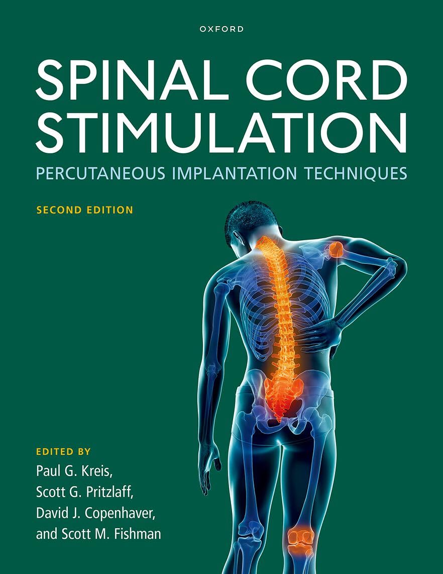 Spinal Cord Stimulation: Percutaneous Implantation Techniques ...
