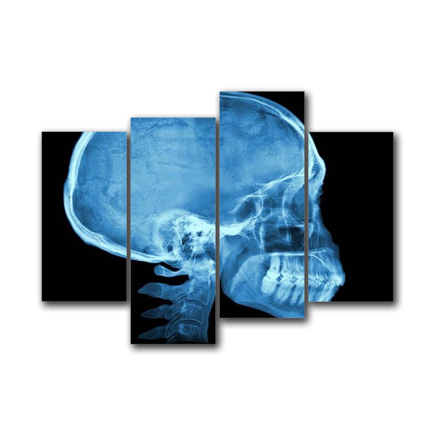 X Ray Of Human Skull