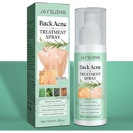 Amazon.com : Back Acne Treatment, Back Acne Spray, 2% Salicylic Acid ...