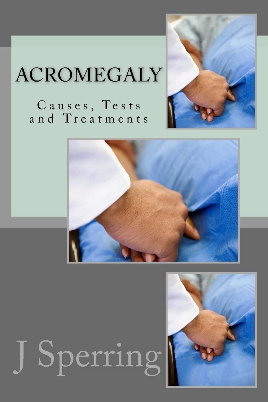 Acromegaly: Causes, Tests and Treatments: Sperring MA, J P, Smith MA, M ...