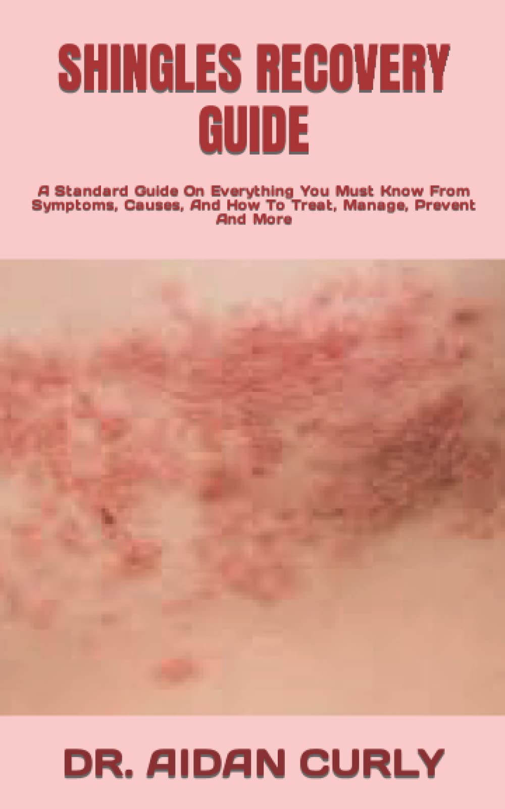 Shingles Recovery Guide A Standard Guide On Everything You Must ...