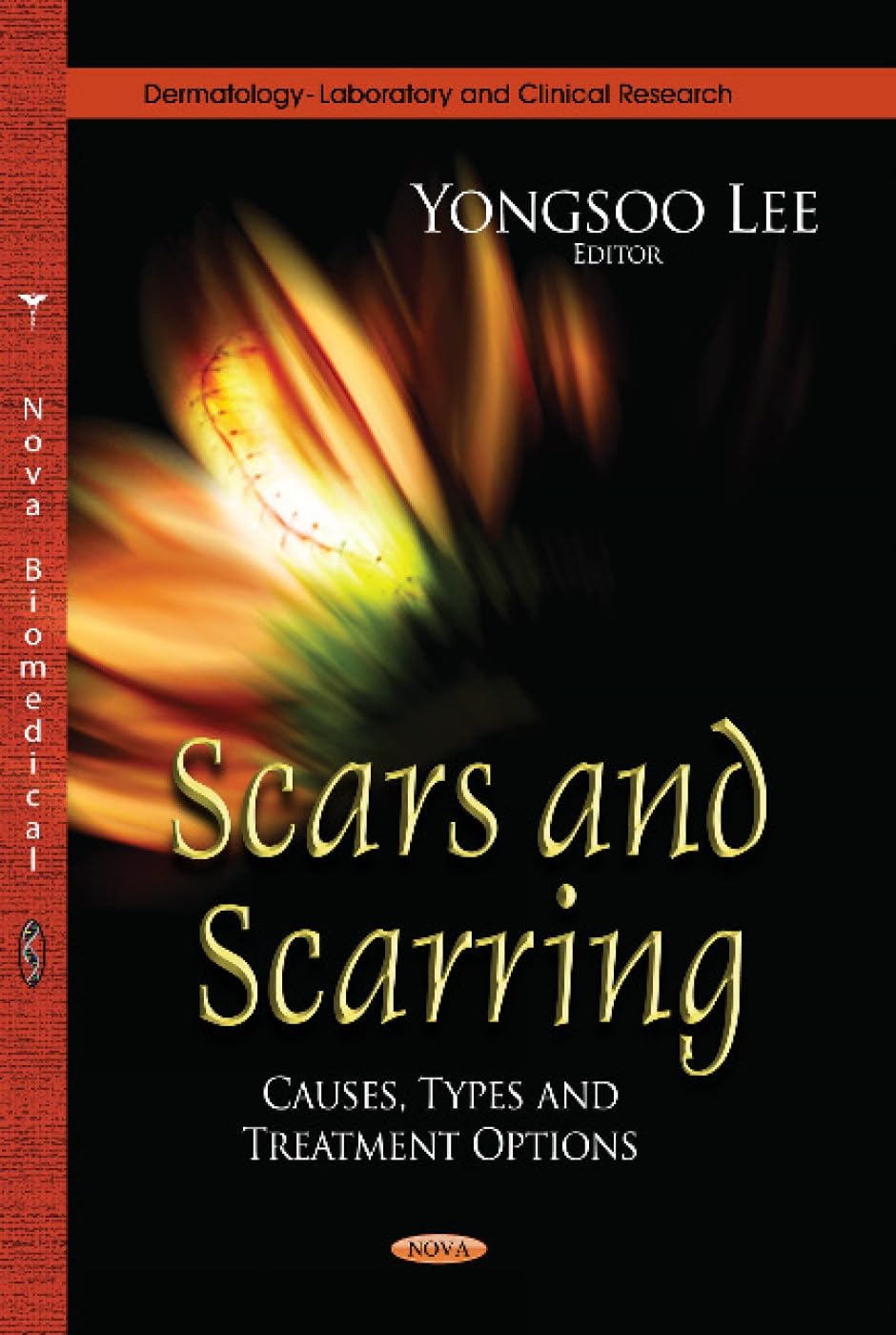 Scars and Scarring: Causes, Types and Treatment Options (Dermatology ...