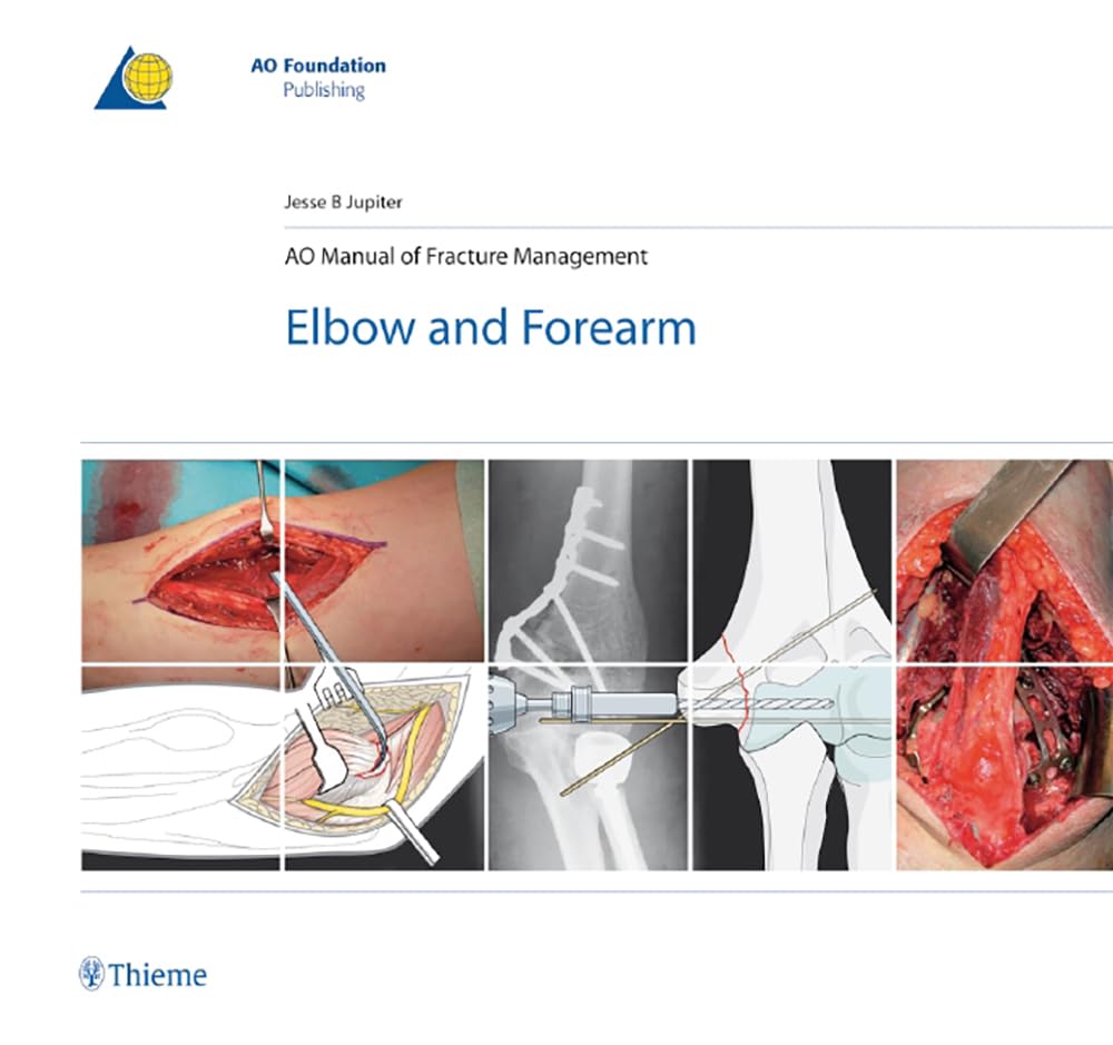 Buy AO Manual of Fracture Management: Elbow and Forearm (AO-Publishing ...