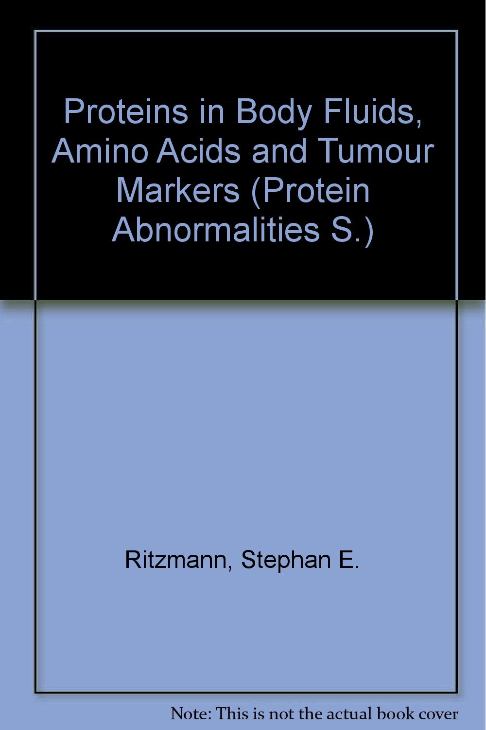 Proteins in Body Fluids, Amino Acids and Tumour Markers (Protein ...