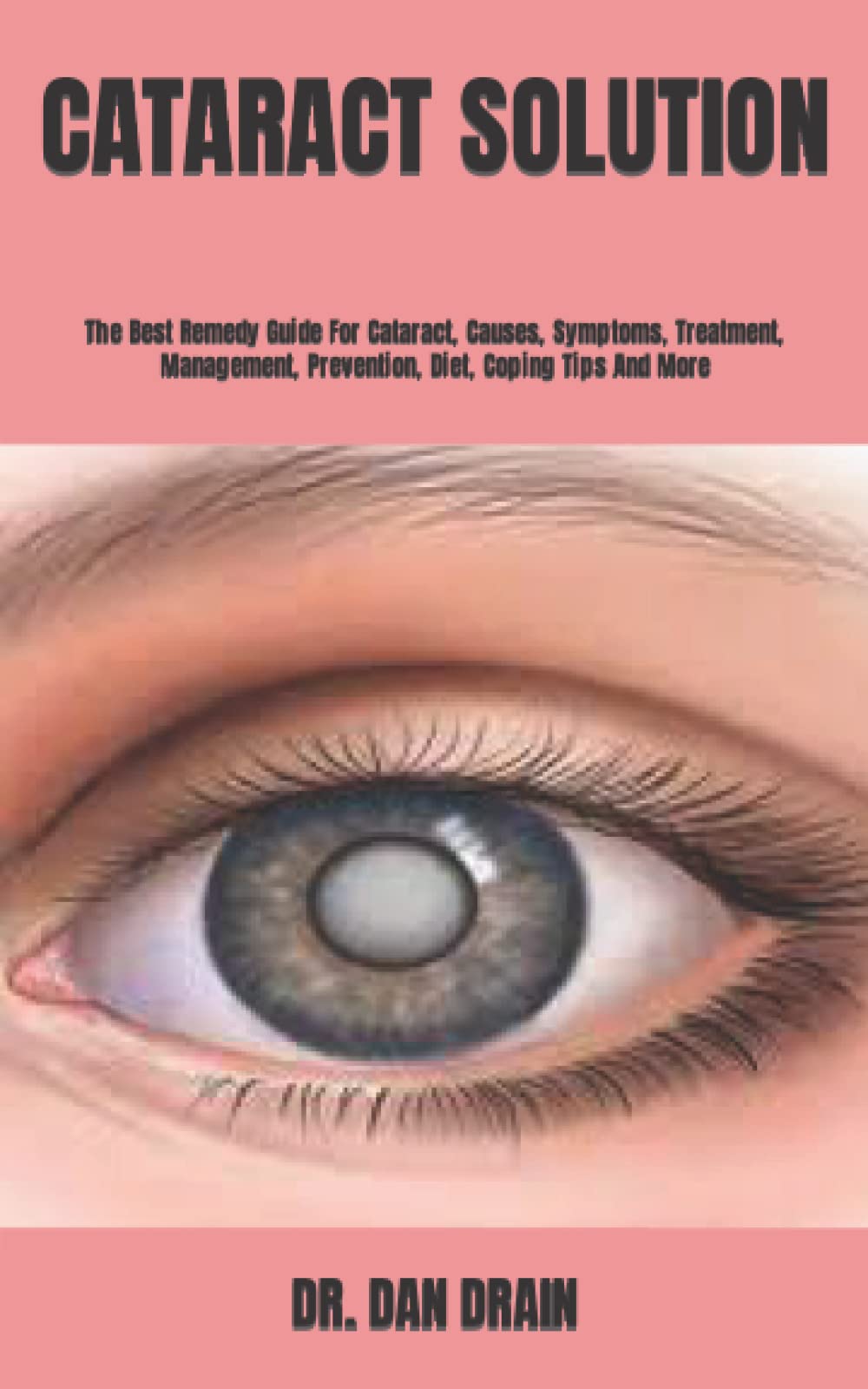 Buy CATARACT SOLUTION: The Best Remedy Guide For Cataract, Causes ...