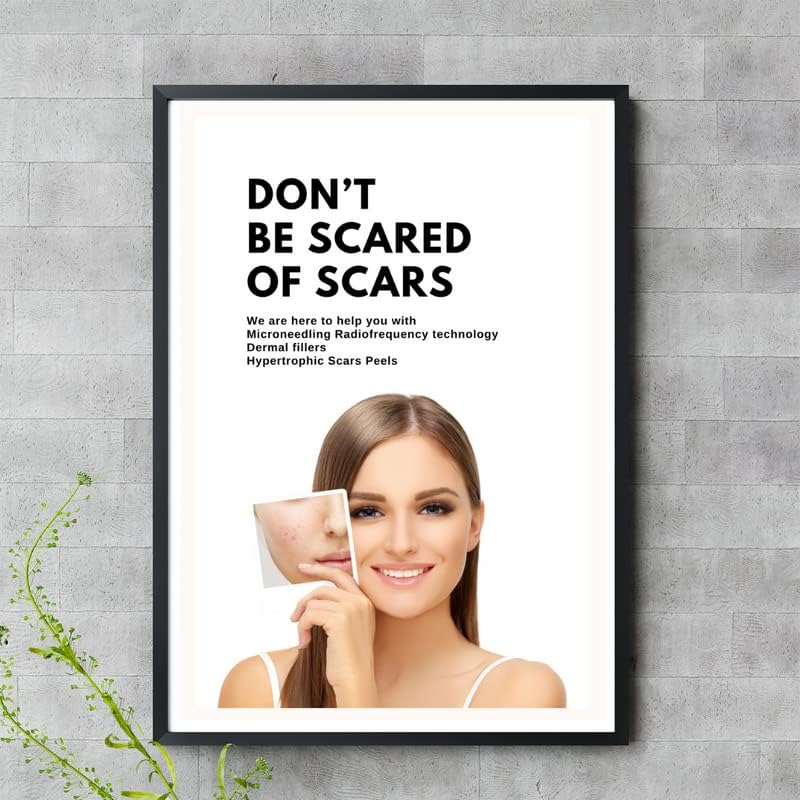 Don Be Scared Scar Skin Treatment Poster Without Frame : Amazon.in ...