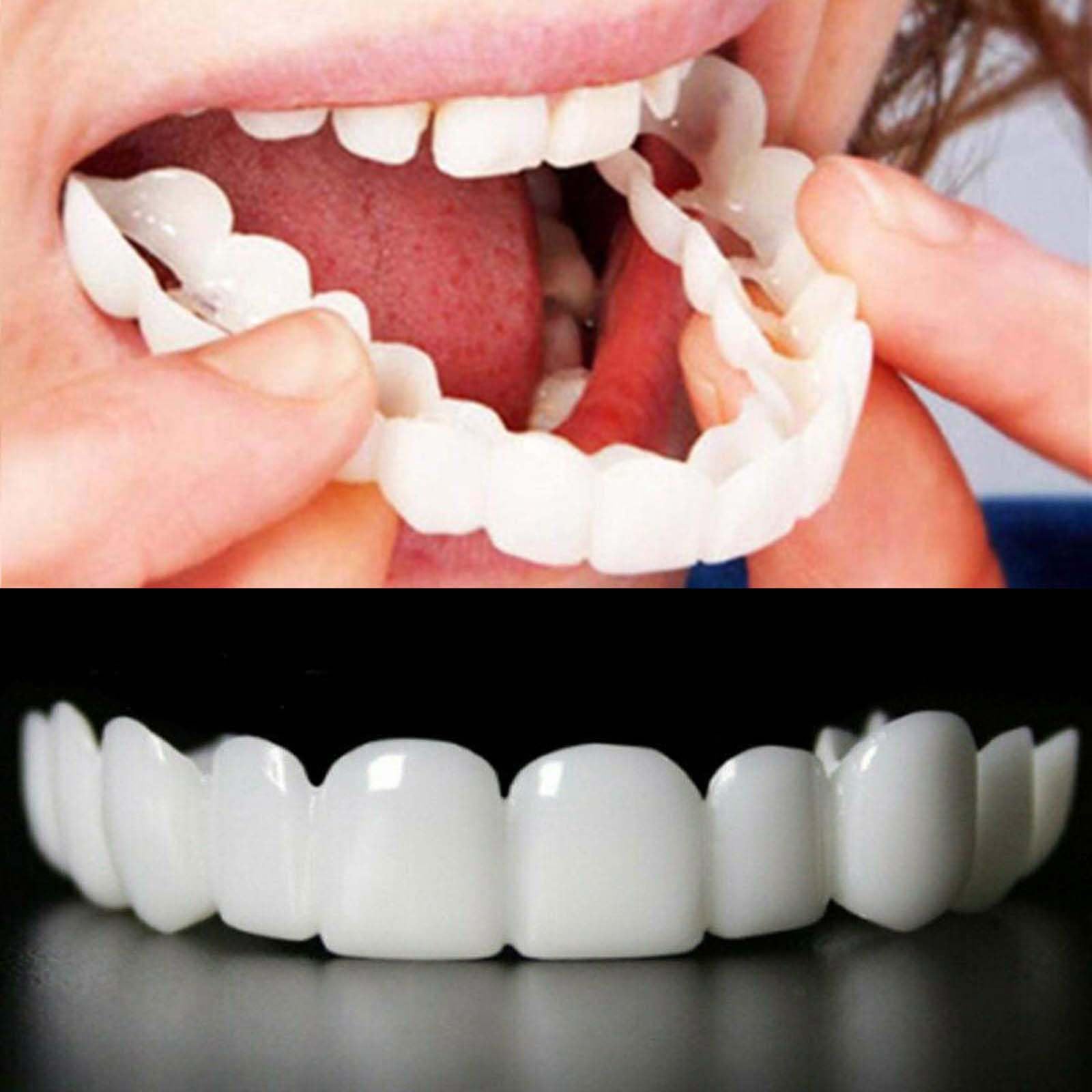 Snapklik.com : Renyqatt Tooth Repair Kit Moldable False Teeth DIY ...