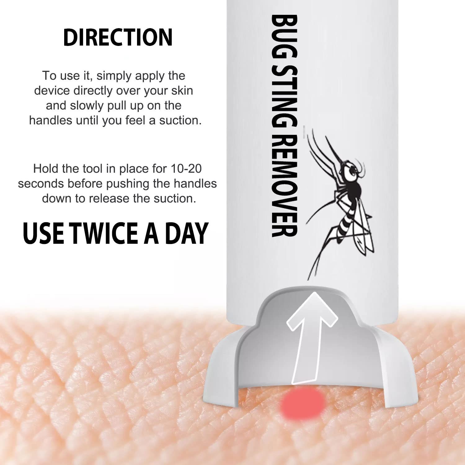 Bug BITE/STINGS Extractor Relief- (Hornets) Yellow Jackets Sting/Wasps ...