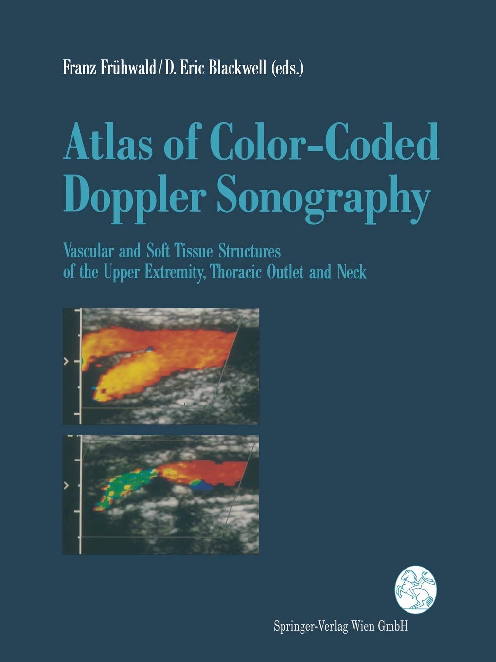 Buy Atlas of Color-Coded Doppler Sonography: Vascular and Soft Tissue ...