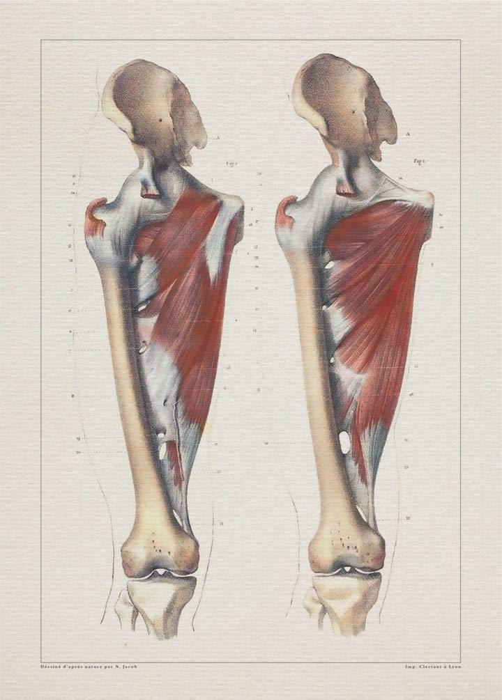 Amazon.com: Anatomy HIP FEMUR JOINT print SRA3 12x18 conqueror laid ...
