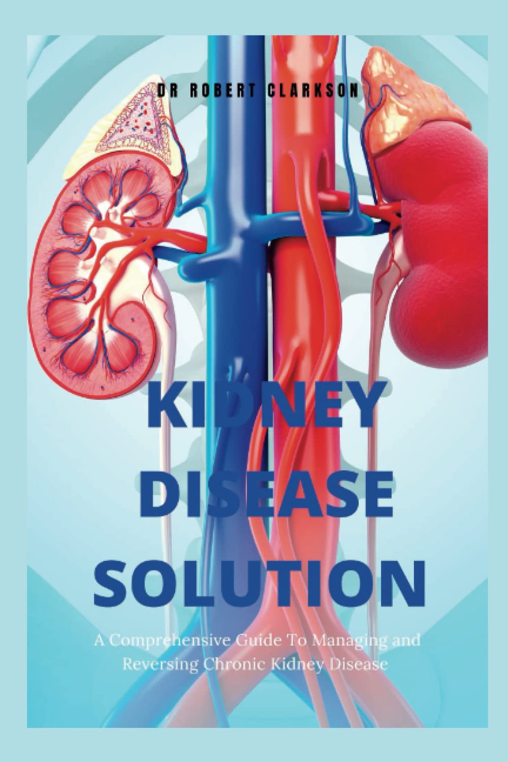 The Kidney Disease Solution: A Comprehensive Guide to Managing and Reversing Chronic Kidney ...