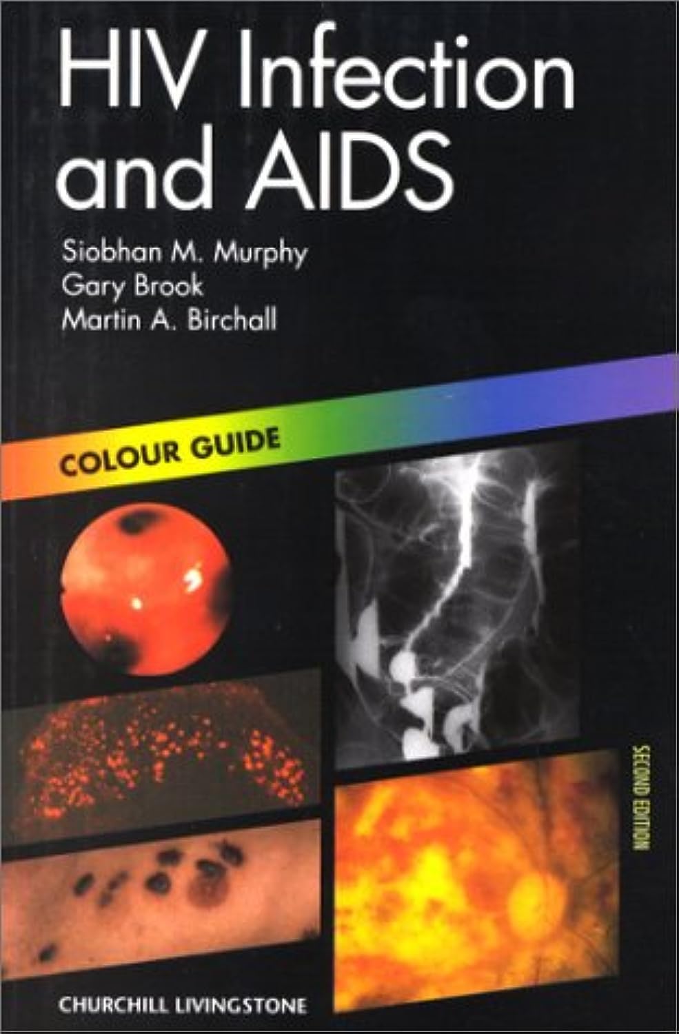 HIV Infection and Aids: Colour Guide (Colour Guides): Murphy FRCPI ...