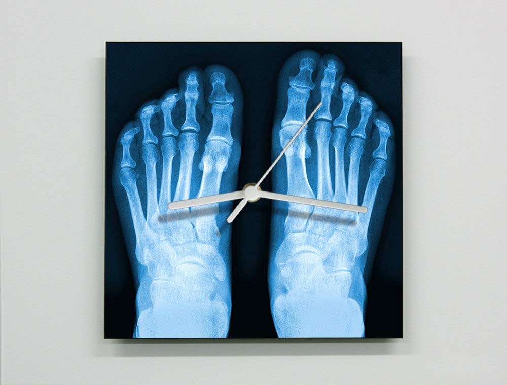 Amazon.com: X-Ray Foot Wall Clock : Handmade Products