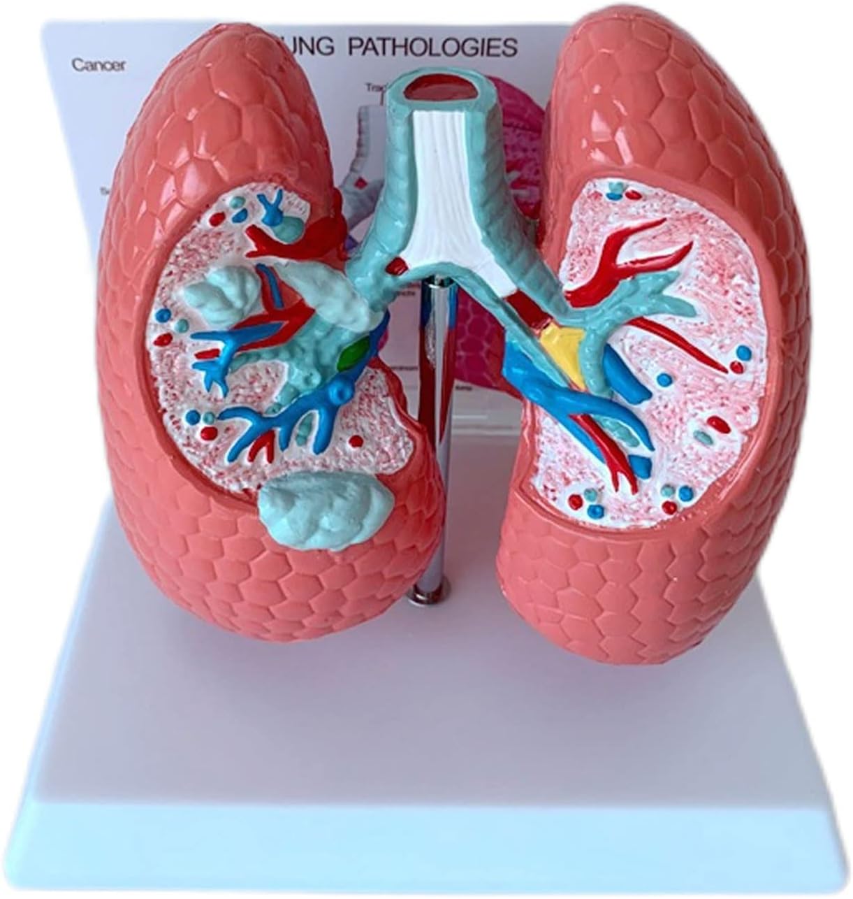 Modelo Anatómico De Patologías Pulmonares - 1: 1 Pulmón Respiratorio De ...