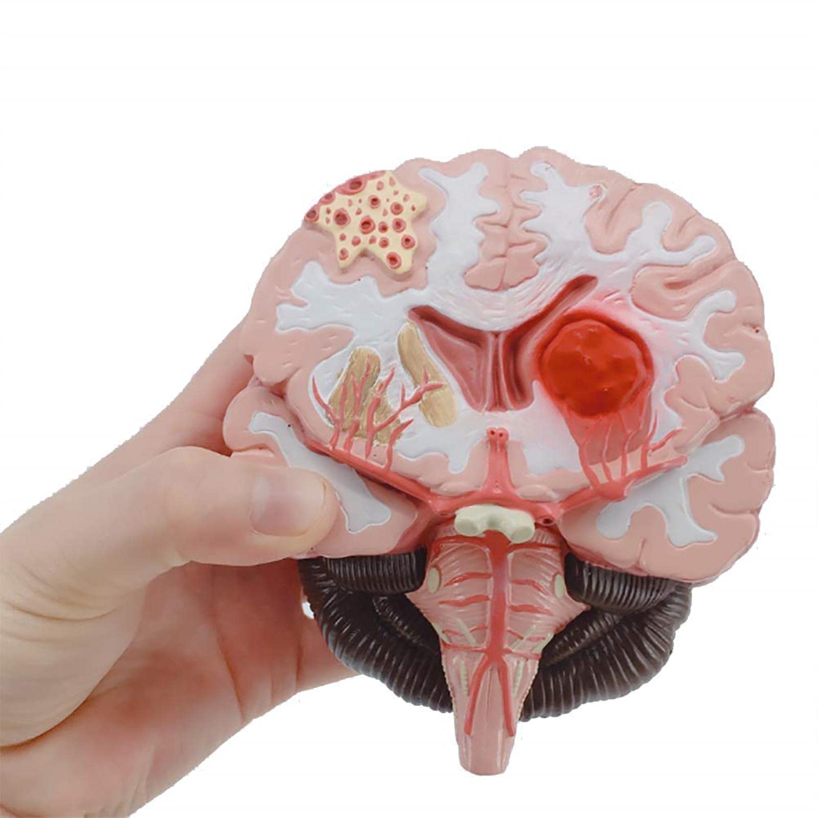 Buy RTYUI Medical Model Humans Brain Disease Model Brain Anatomical ...