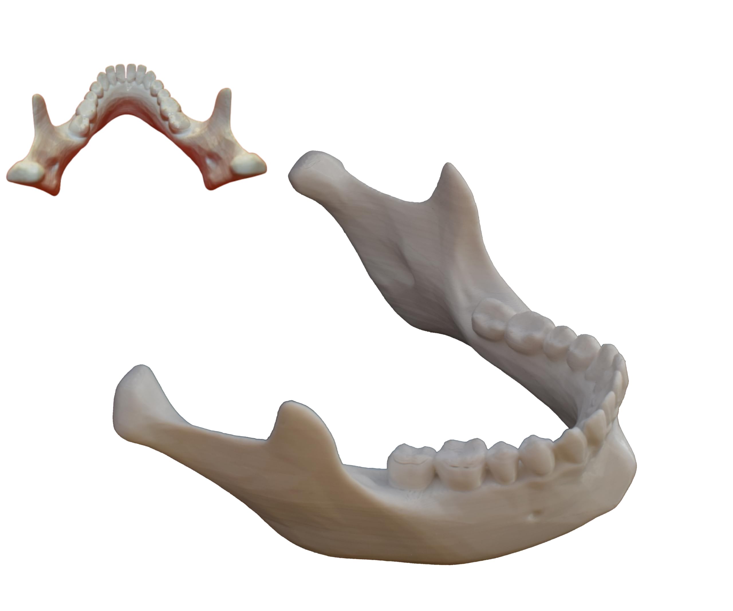 Mandible Bone What Is Jaw Bone Resorption? What Are The Symptoms?