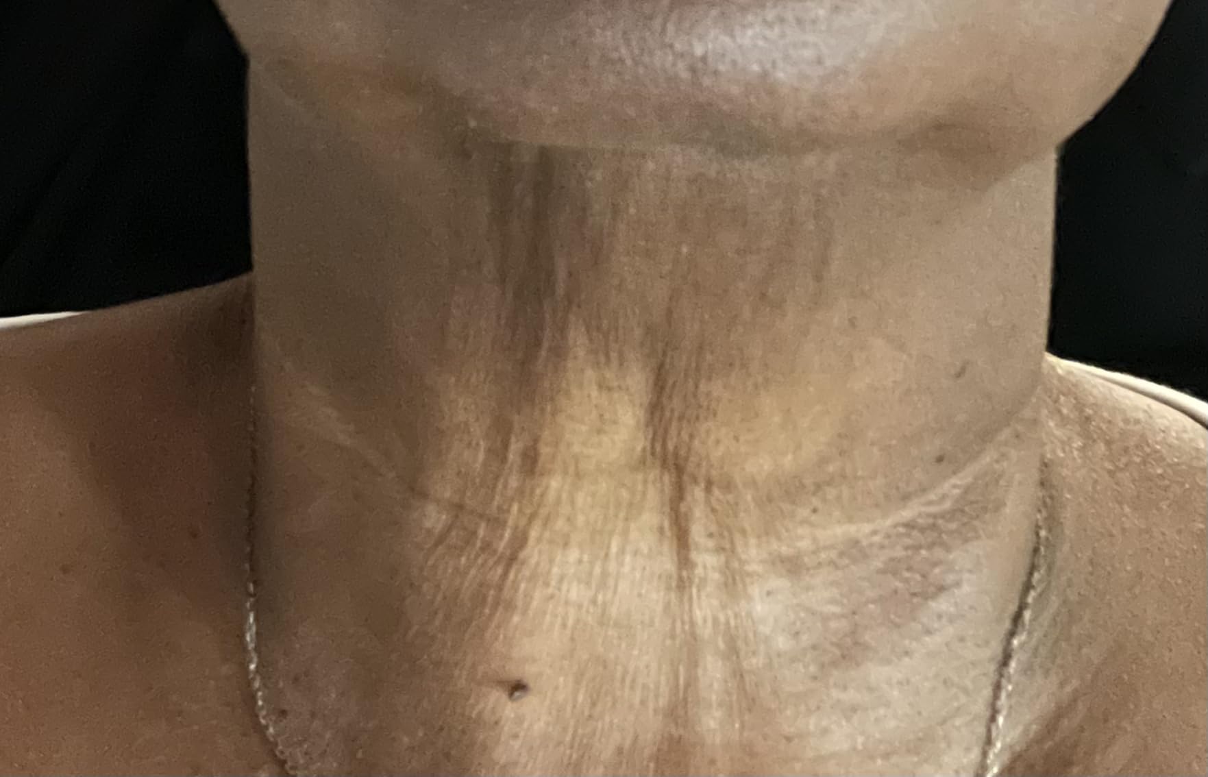 Amazon.com: LEMCUH Neck Firming Cream, Cream Tightening Lifting Sagging ...