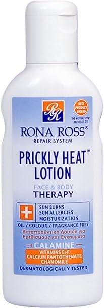 Rona Ross Prickly Heat Lotion : Amazon.co.uk: Beauty