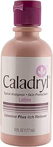 Amazon.com: Caladryl Pink Calamine Skin Protectant Plus Itch Relief, 6 ...