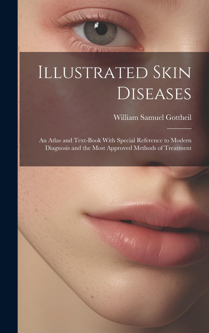 Buy Illustrated Skin Diseases: An Atlas and Text-Book With Special ...
