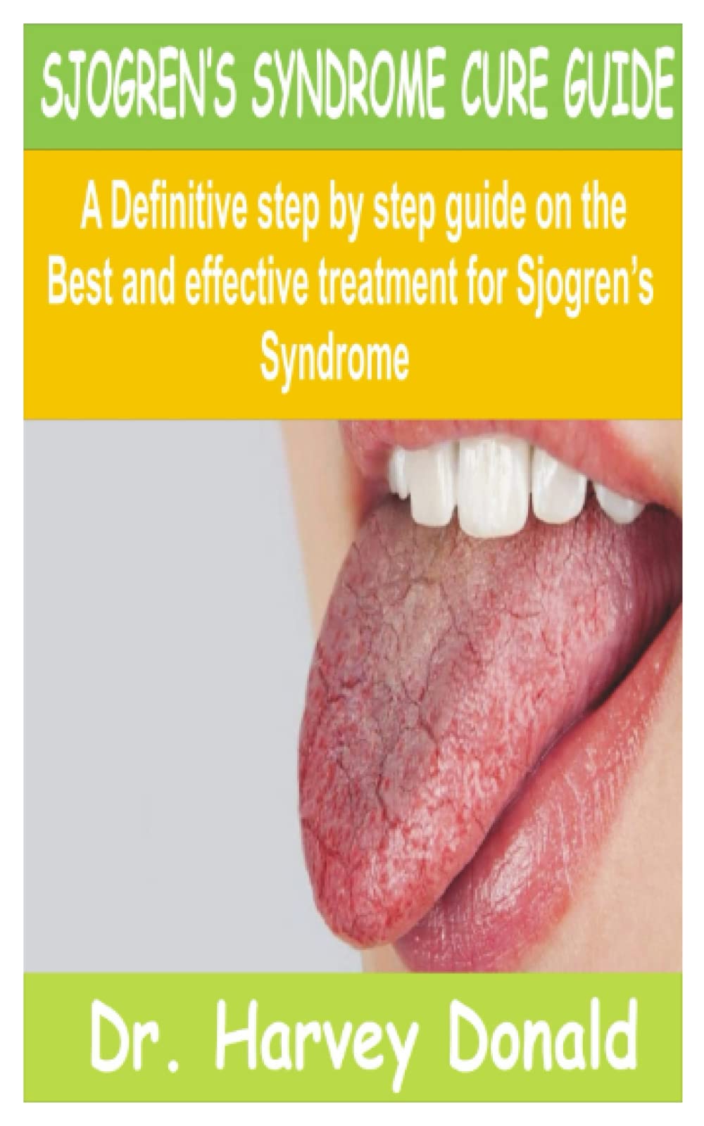 SJOGREN’S SYNDROME CURE GUIDE: A Definitive step by step guide on the ...