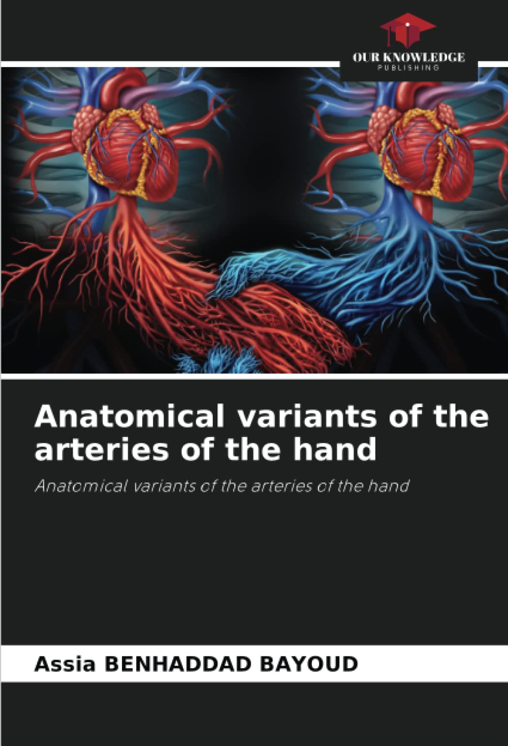 Buy Anatomical variants of the arteries of the hand: Anatomical ...