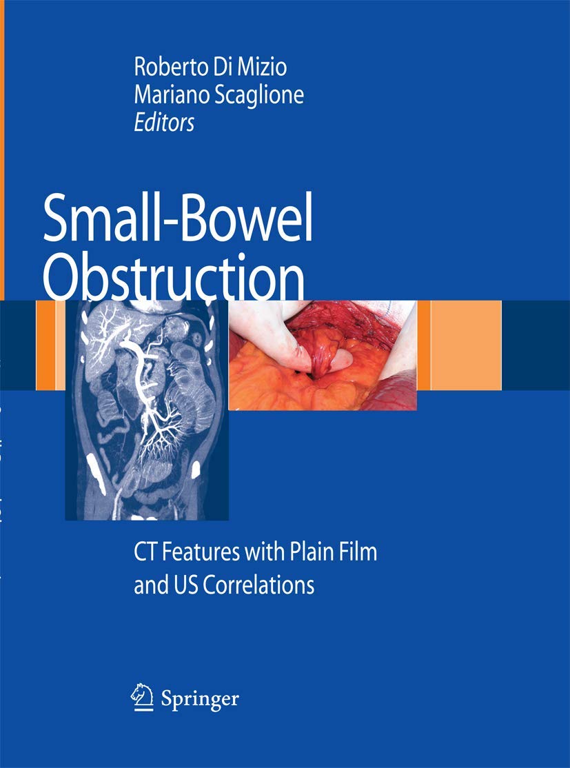 Small-Bowel Obstruction: CT Features with Plain Film and US ...