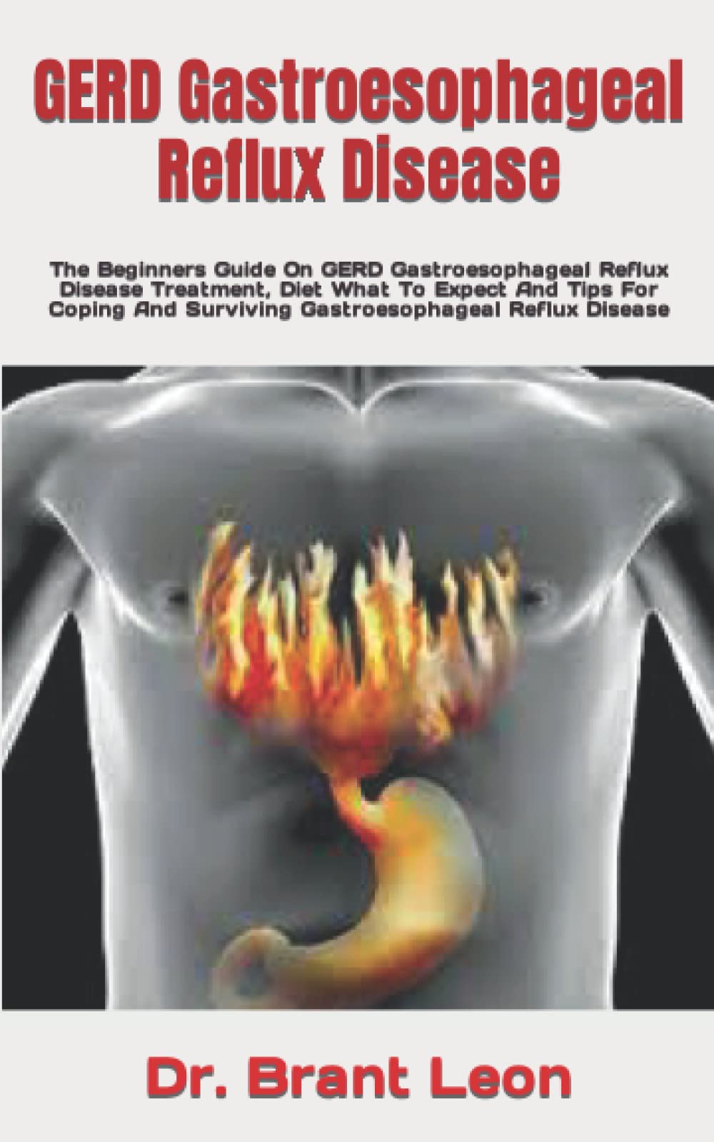 Gerd Gastroesophageal Reflux Disease The Beginners Guide On Gerd ...
