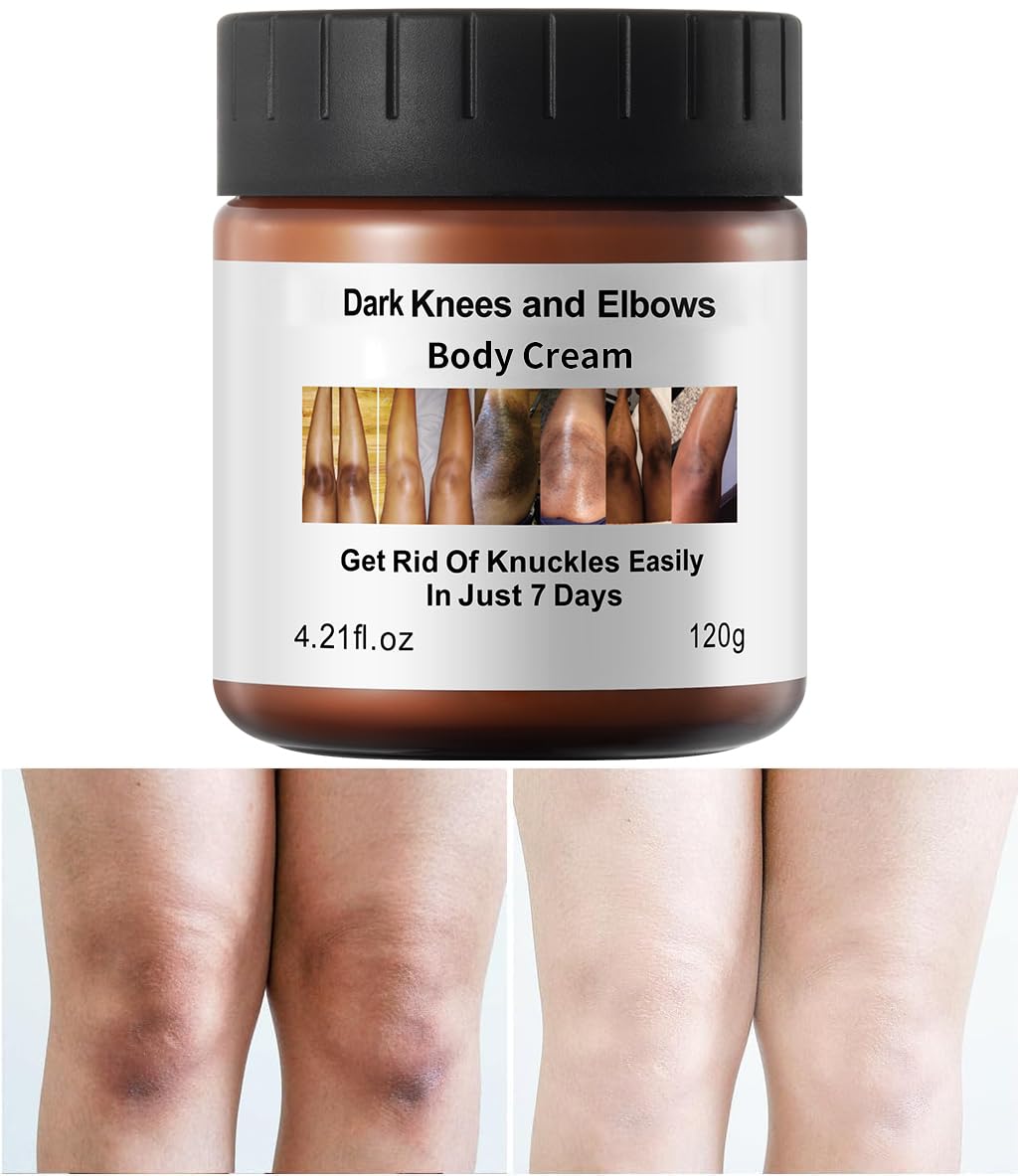 Dark Knees Elbows Knuckles Corrector Cream Skin Cleaning Bleaching ...