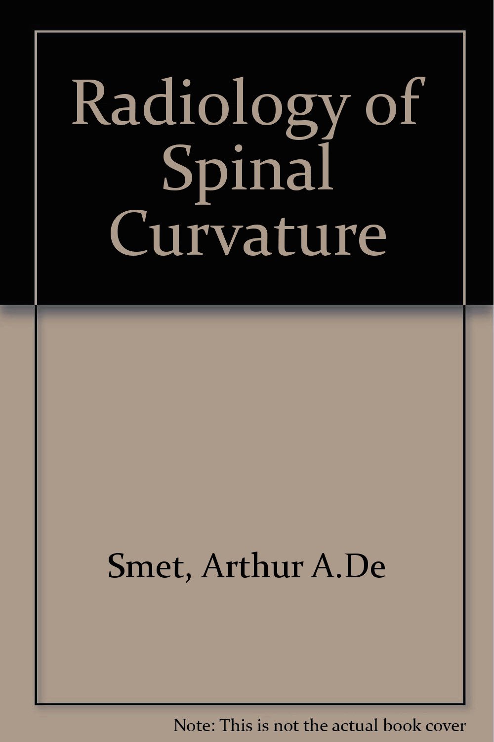 Radiology of Spinal Curvature: 9780801612640: Books - Amazon.ca