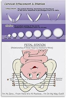 Stroke And Eye: Pupil Dilation As A Warning Sign | MedShun