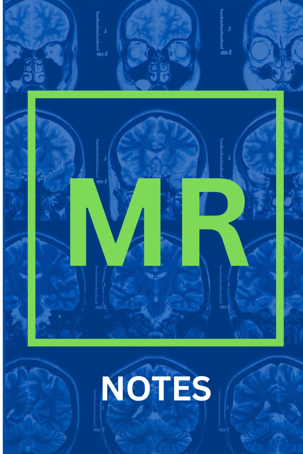 Snapklik.com : MRI NOTEBOOK-MR NOTES: 6X9 NOTEBOOK FOR MRI NOTES-WORK ...