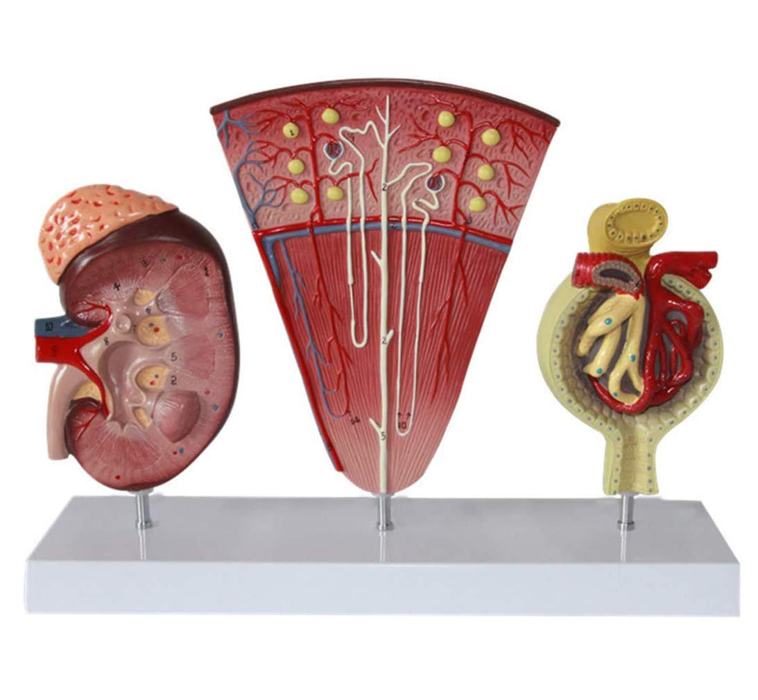 Buy 3 Times d Human Kidney Anatomical Model, Consists of Kidney Section ...