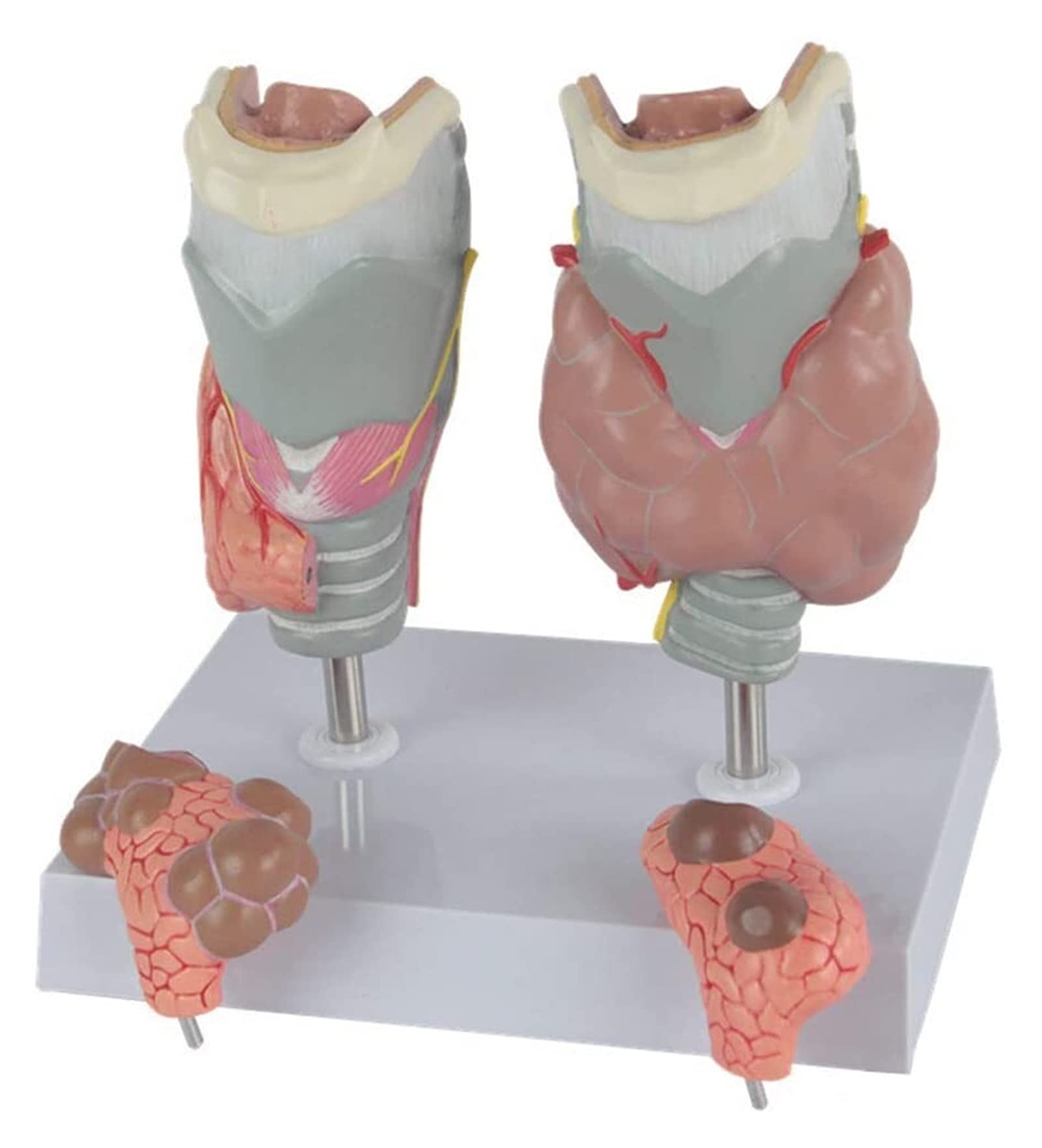 Buy Medical Models, Human Anatomy Science Models Thyroid Pathology ...