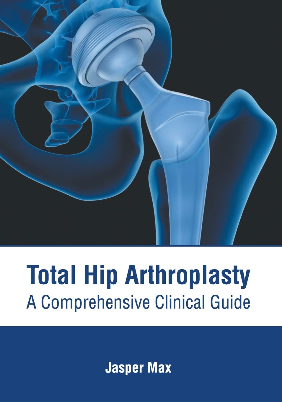 Total Hip Arthroplasty: A Comprehensive Clinical Guide: 9781639274048 ...