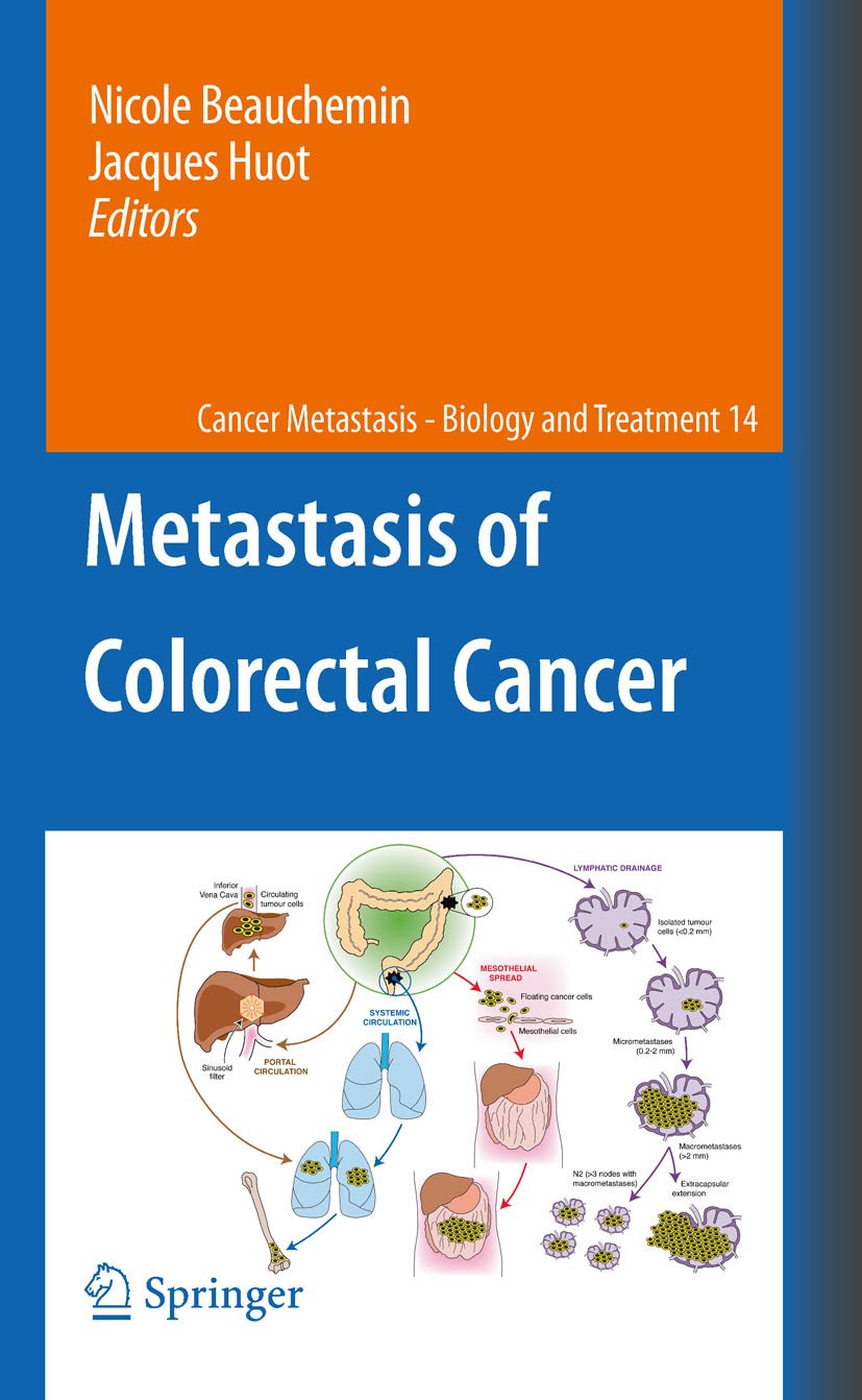 Metastasis of Colorectal Cancer (Cancer Metastasis - Biology and ...