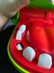 Hasbro Crocodile Dentist Kids Game Ages 4 and Up (Amazon Exclusive ...
