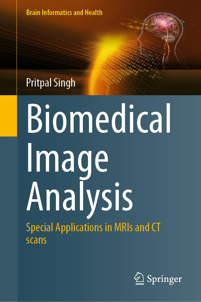 Biomedical Image Analysis: Special Applications in MRIs and CT scans (Brain Informatics and ...