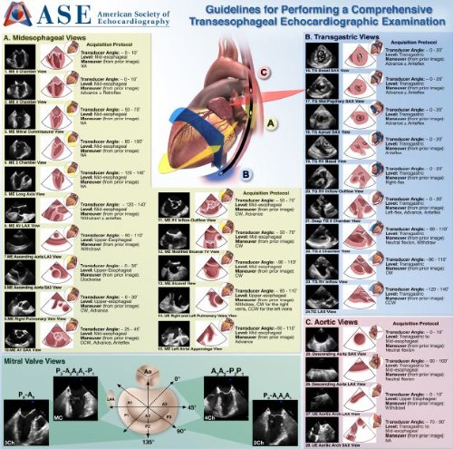 Guidelines For Performing A Comprehensive Transesophageal