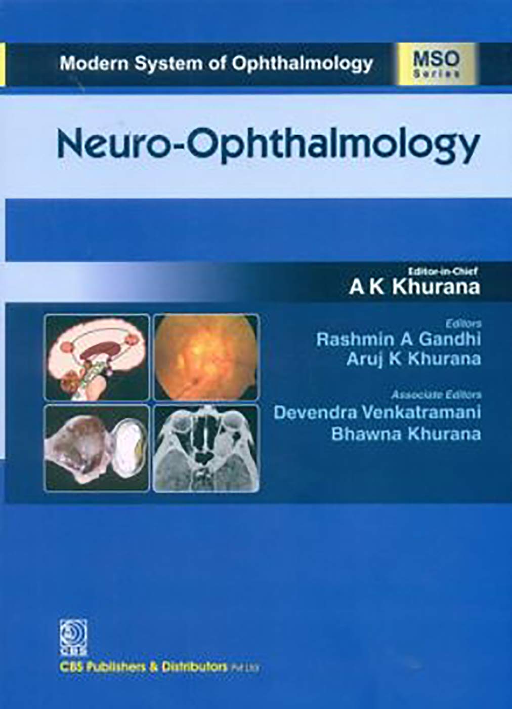 Amazon | Neuro-ophthalmology (Modern System of Ophthalmology) | Khurana ...