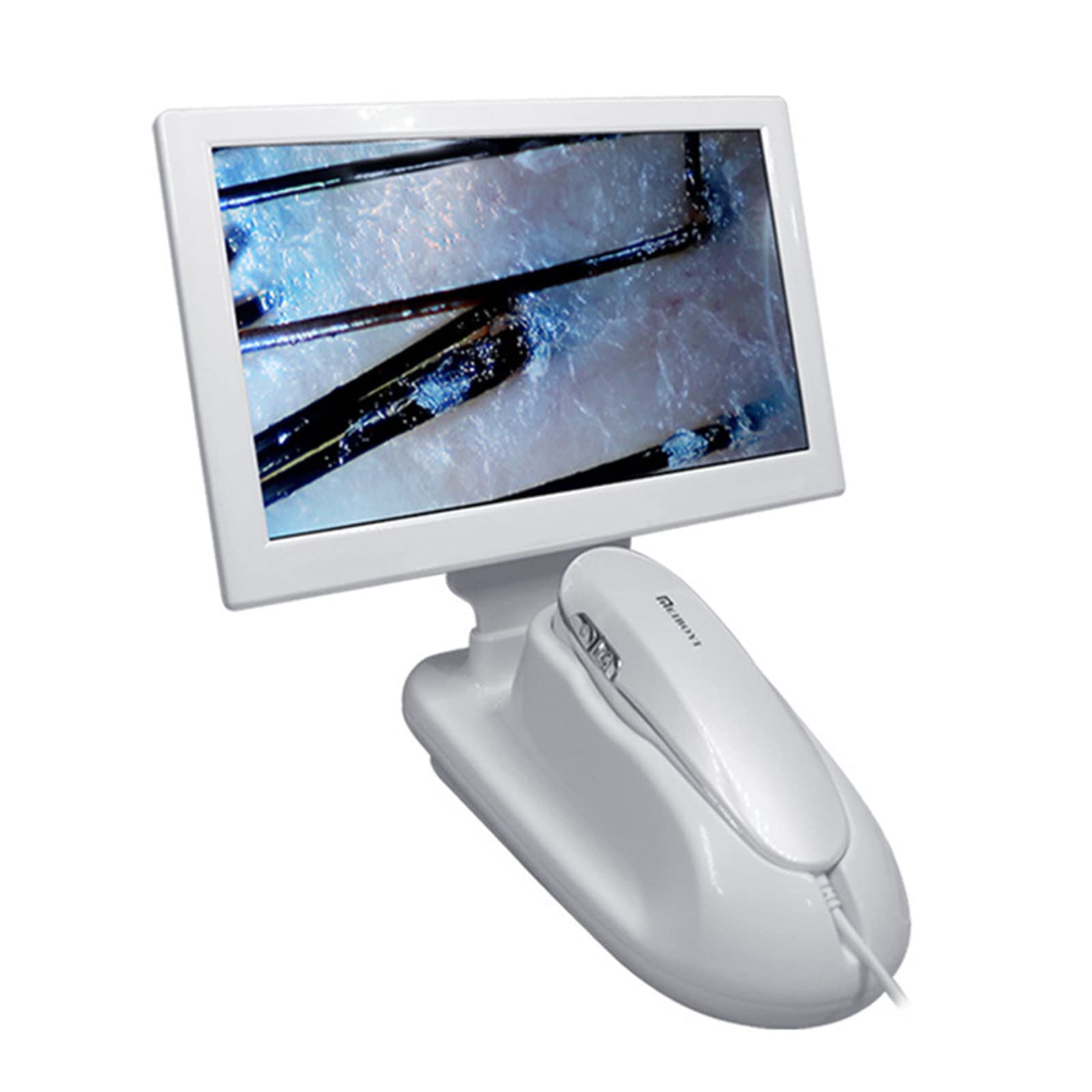 Buy Skin Hair Analyzer, Dual Lens Hair Diagnosis Analyzer, 11 Inch LCD ...