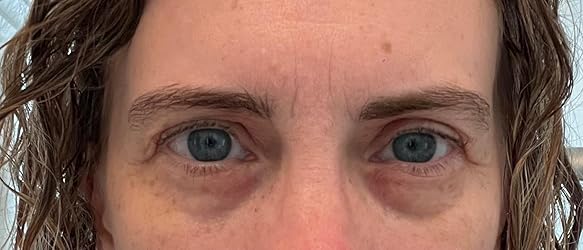 Amazon.com : DRMTLGY Brightening Eye Masks (30 Pairs) - Caffeine Eye ...