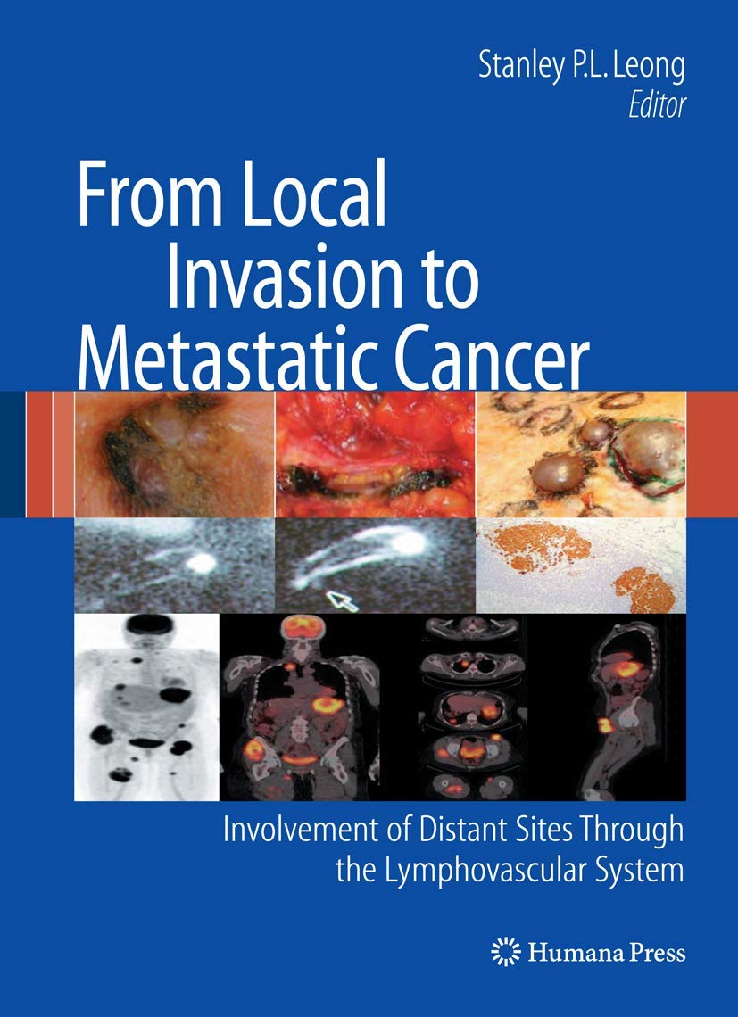 From Local Invasion to Metastatic Cancer: Involvement of Distant Sites ...