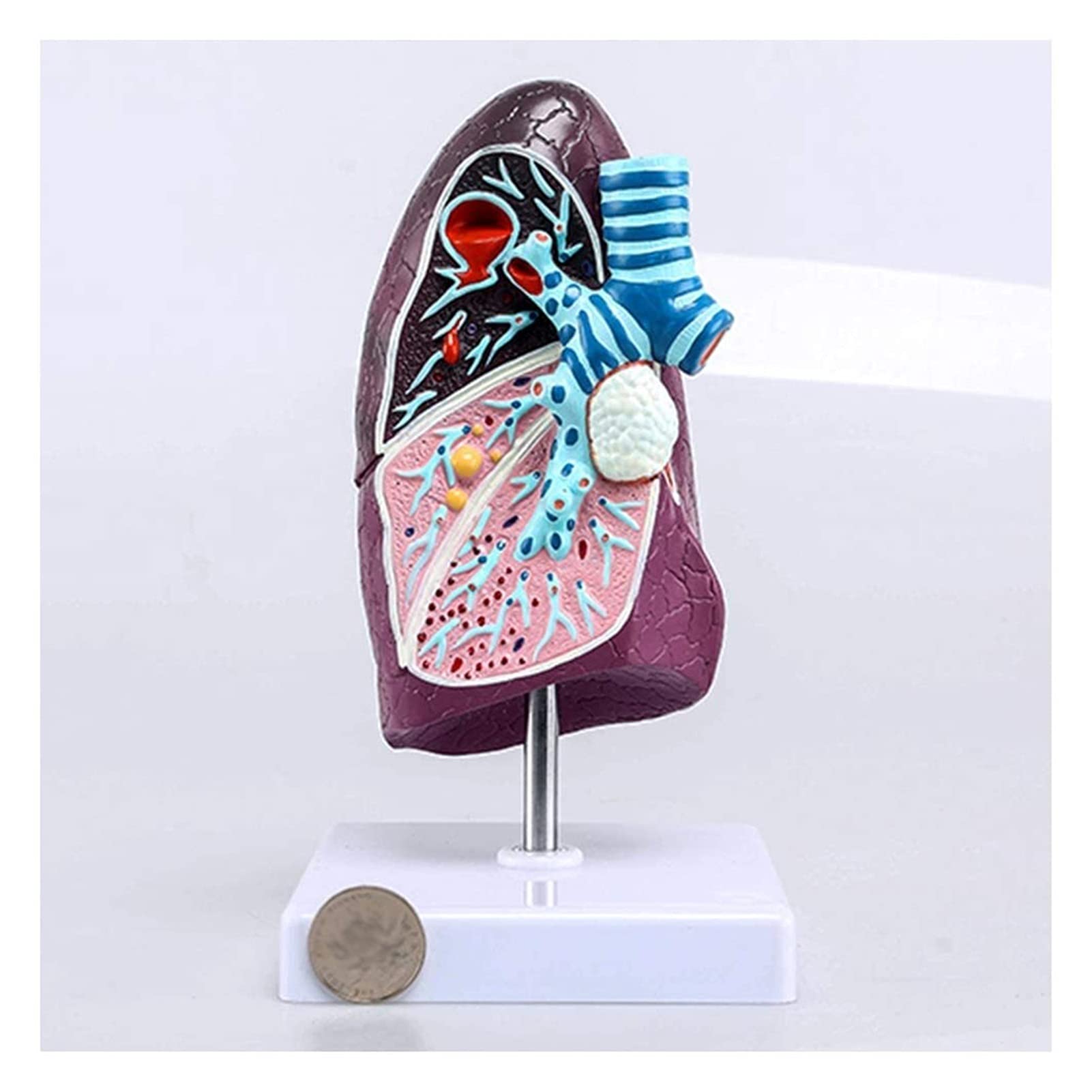 Jkfzd Human Lung Model Genuine Diseased Lung Anatomical Model Teaching ...