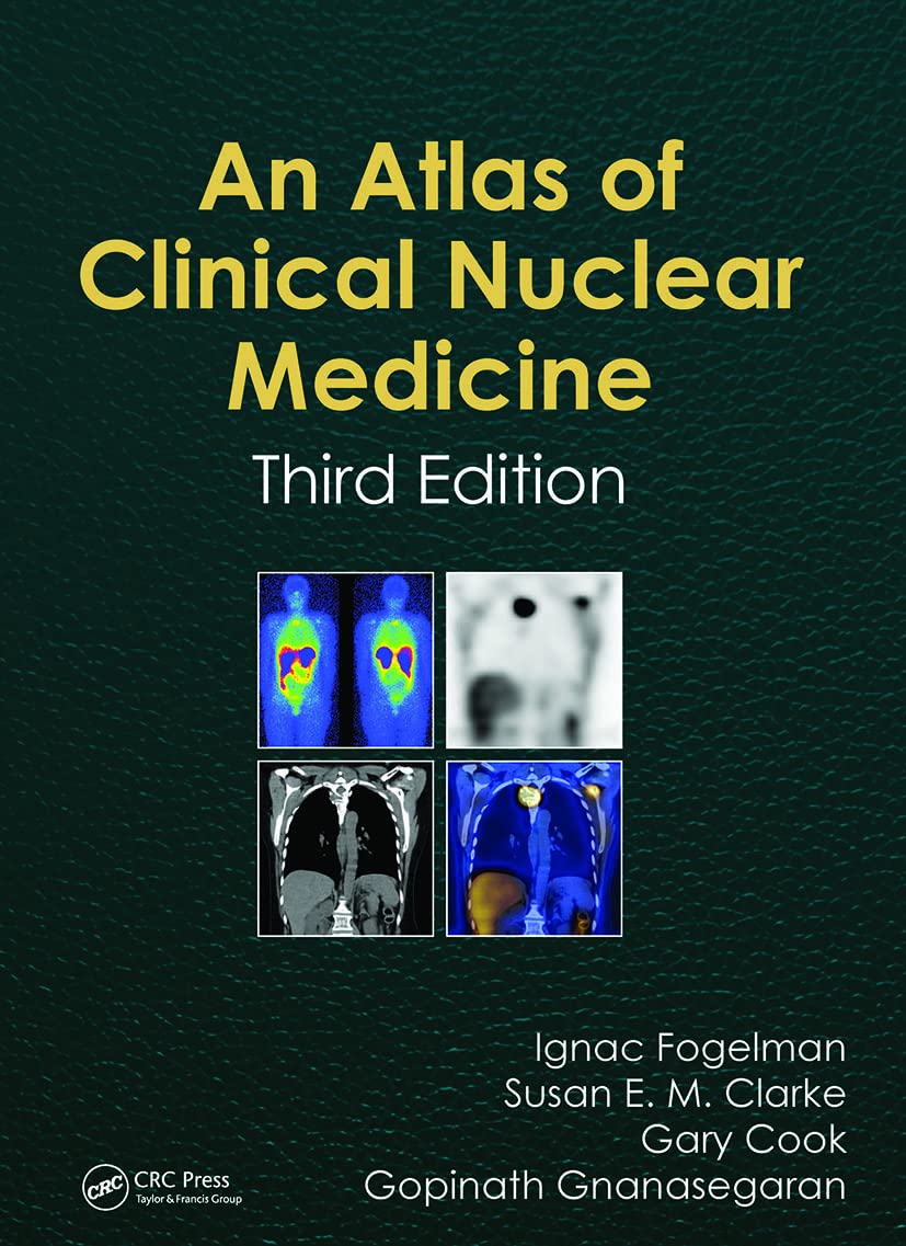Atlas of Clinical Nuclear Medicine: 9781841846538: Medicine & Health ...