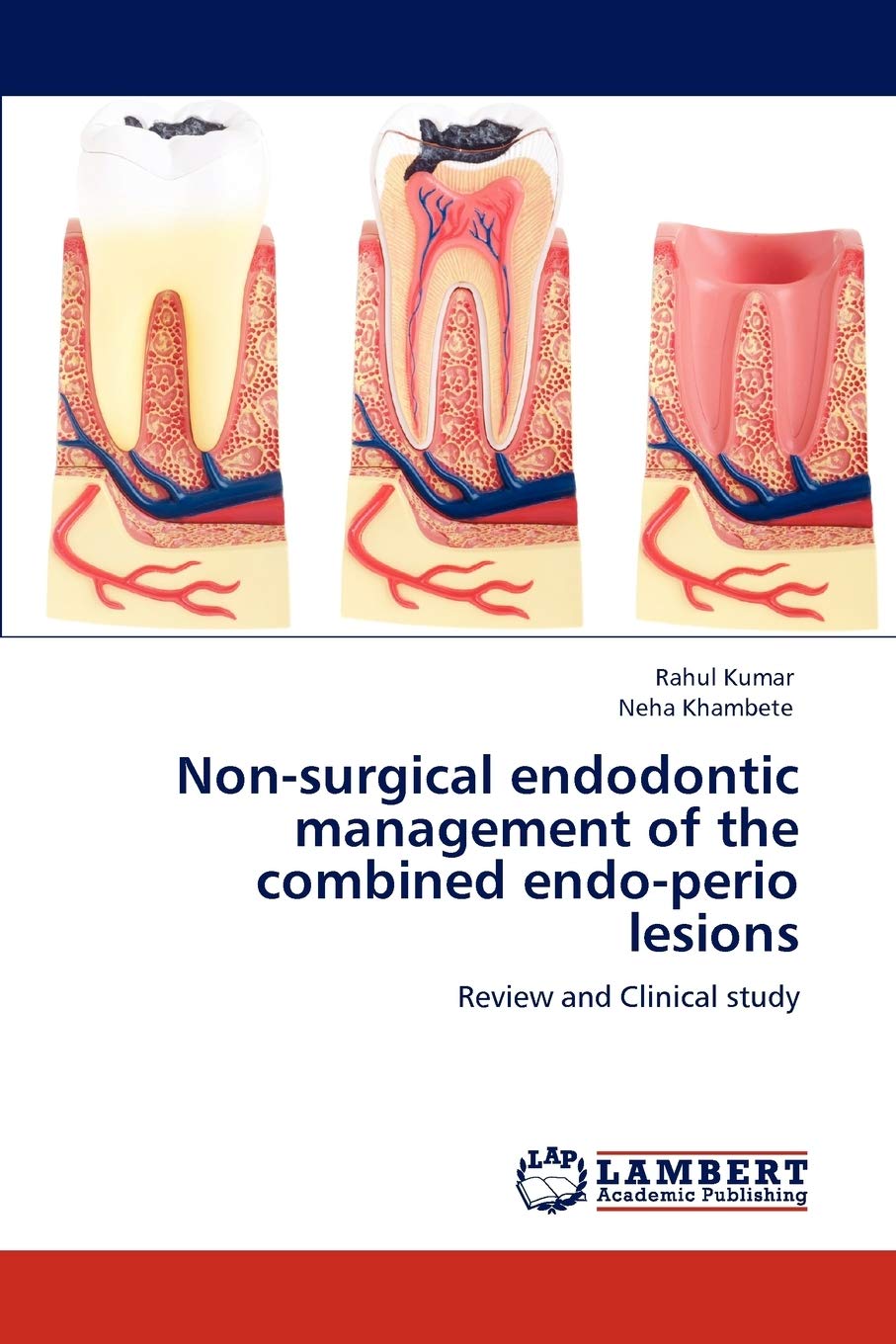 Non-surgical endodontic management of the combined endo-perio lesions ...