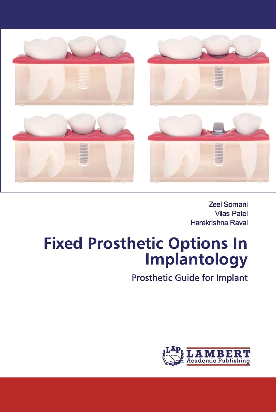 Fixed Prosthetic Options In Implantology Prosthetic Guide For Implant | Desertcart INDIA