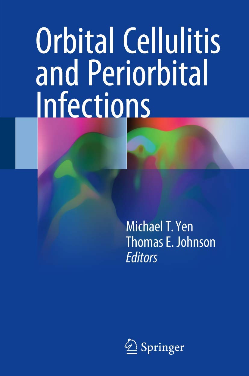 Periorbital Vs Orbital Cellulitis Peri Orbital Vs Orbital Cellulitis